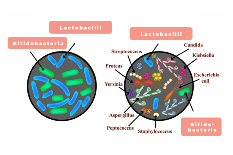 IBS и чревна микробиота | h-biota.com